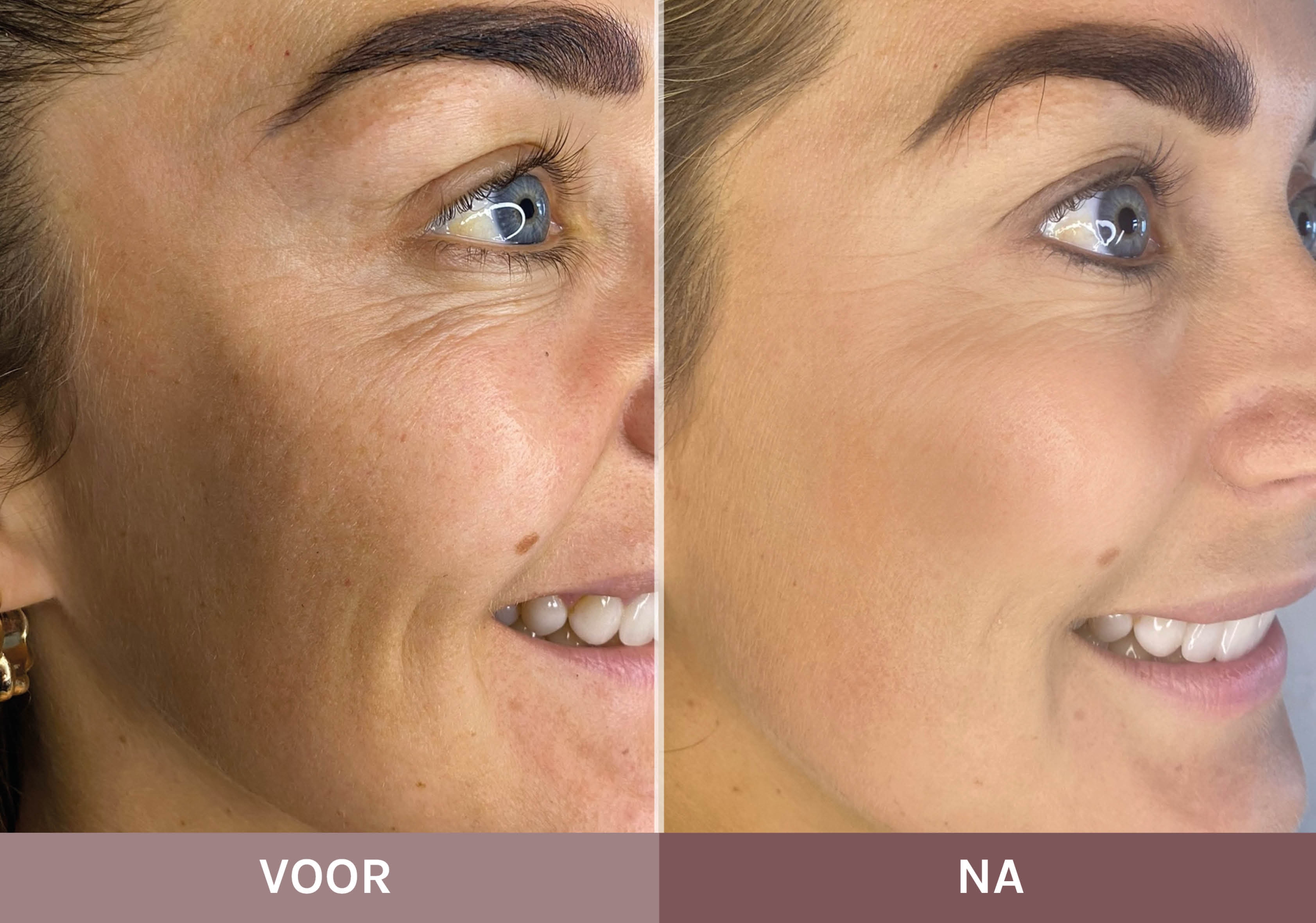 RESULTS | MUZE Skincare